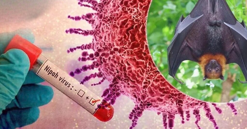 Nipah Virus Is Quietly Present in Indonesia, Scientists Warn of ...